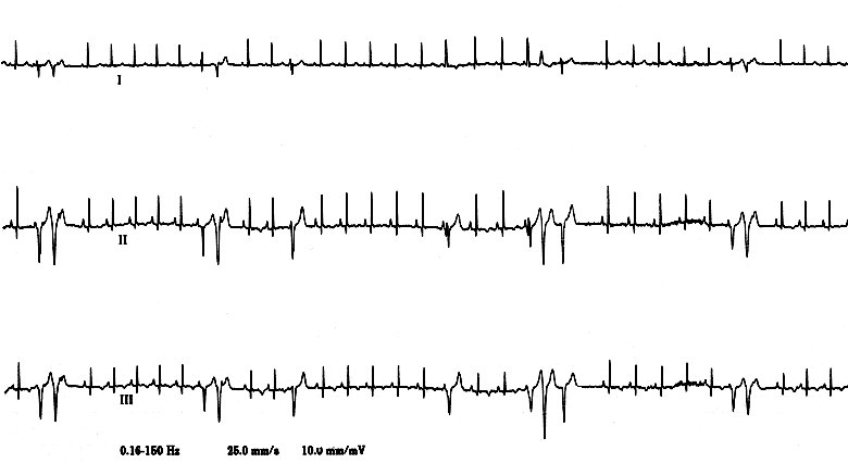 EKG Quizz 6- Frage 1